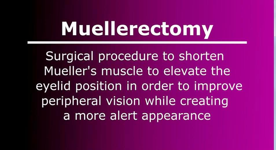 Muellerectomy (Eyelid Tightening Surgery)