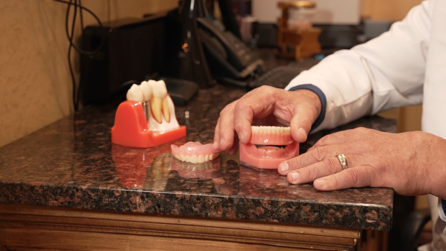 Implant Dentures Colorado Springs, CO - Rota Advanced Dental Care